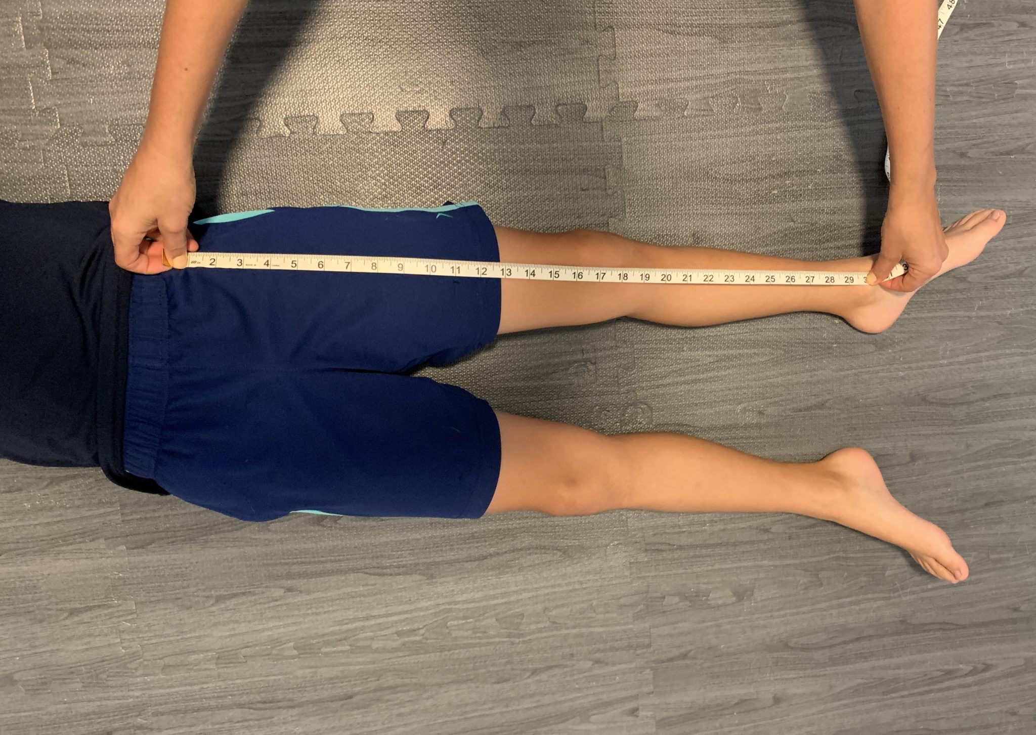 Common Questions About Scoliosis and Leg Length Discrepancy